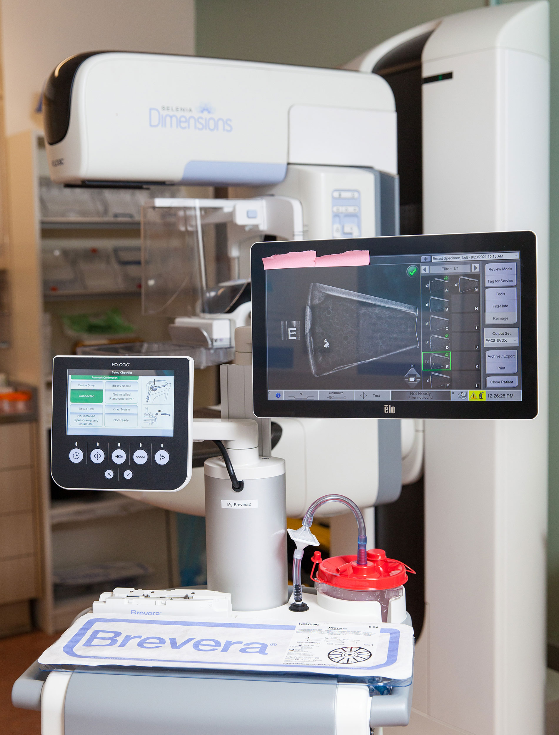 St. Michael’s pilots breast cancer biopsy system to make biopsies less ...