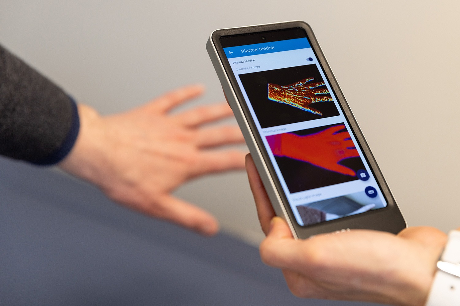 St. Michael’s Hospital receives funding for MIMOSA Pro device to treat ...